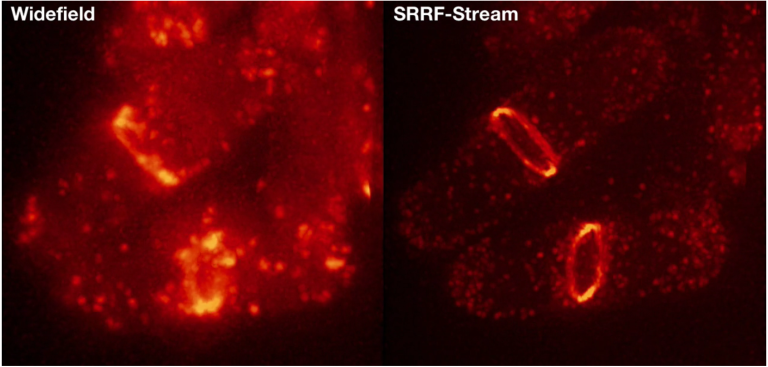 iXon SRRF-Stream超分辨率显微功能 - 北京鼎信优威光子科技有限公司