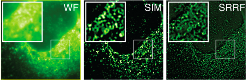 iXon SRRF-Stream超分辨率显微功能 - 北京鼎信优威光子科技有限公司