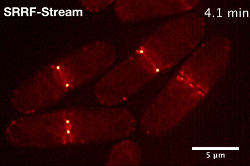 iXon SRRF-Stream超分辨率显微功能 - 北京鼎信优威光子科技有限公司